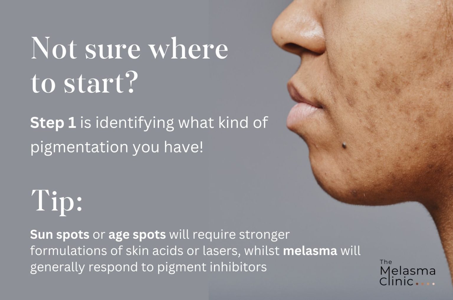 Best Pigmentation Skin Care Guide 2025 | The Melasma Clinic