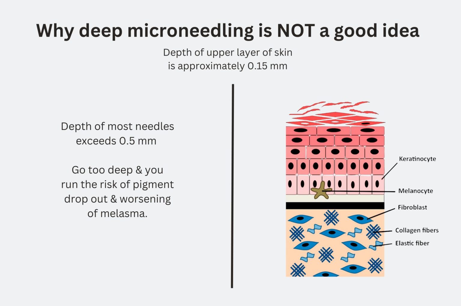 Best Microneedling For Melasma In Brisbane & Sydney Areas