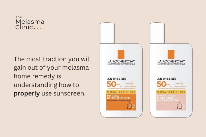 Best & Reliable Melasma Home Remedies 2025 | Melasma Clinic