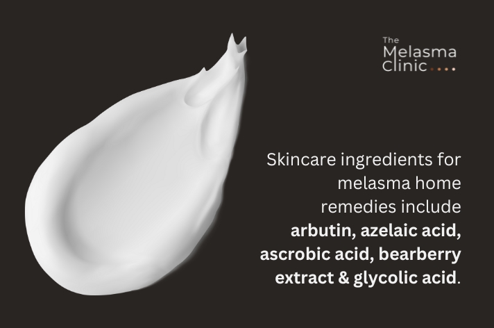 Best & Reliable Melasma Home Remedies 2025 | Melasma Clinic