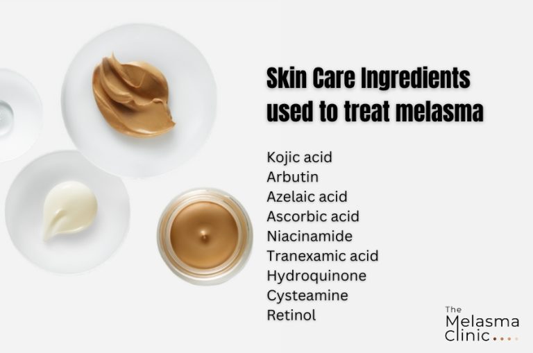 Australia's Best Melasma Treatments | The Melasma Clinic