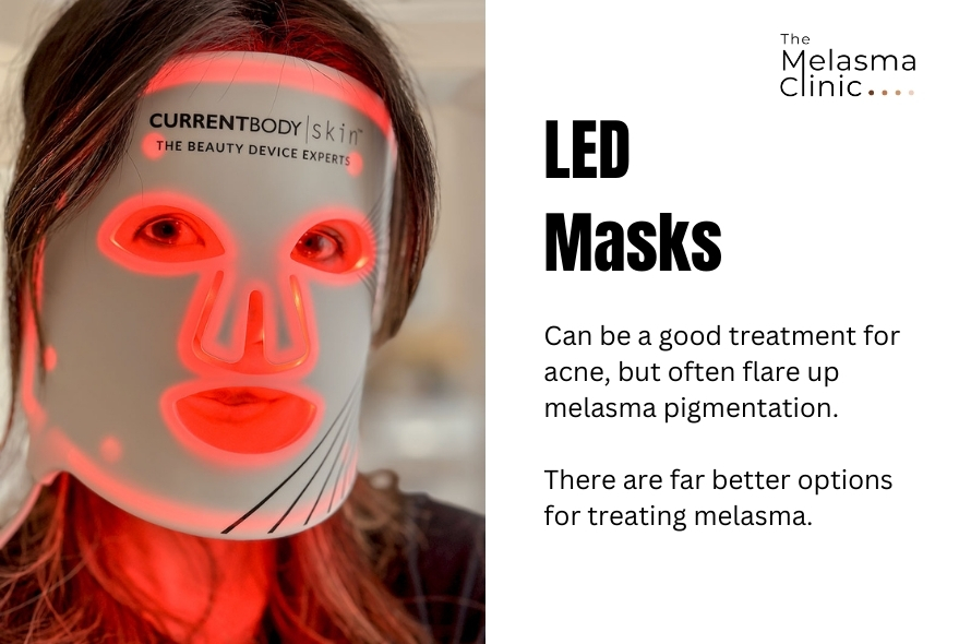 Australia's Best Melasma Treatments | The Melasma Clinic